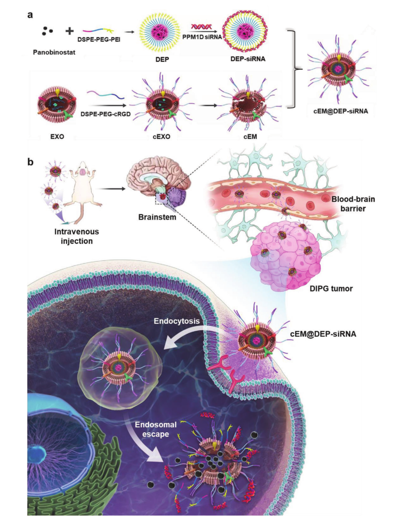 功能化巨噬细胞外泌体治疗弥漫性内生性脑桥胶质瘤 - 河清医学