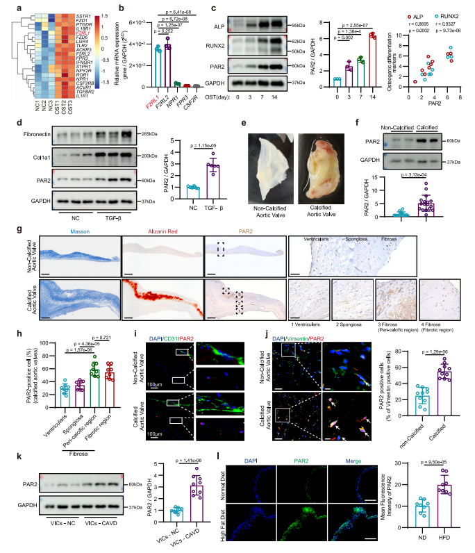 利用靶向PAR2 的磁性纳米载体增强主动脉瓣药物输送以减轻钙化 - 河清医学
